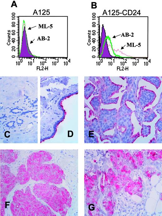 CD24 Expression Is a New Prognostic Marker in Breast Cancer | Clinical ...