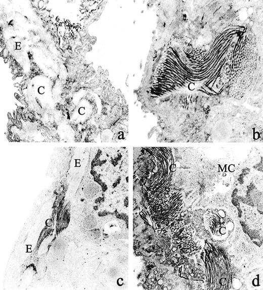 Dual Action of NAMI-A in Inhibition of Solid Tumor Metastasis ...