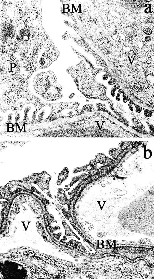 Dual Action of NAMI-A in Inhibition of Solid Tumor Metastasis ...