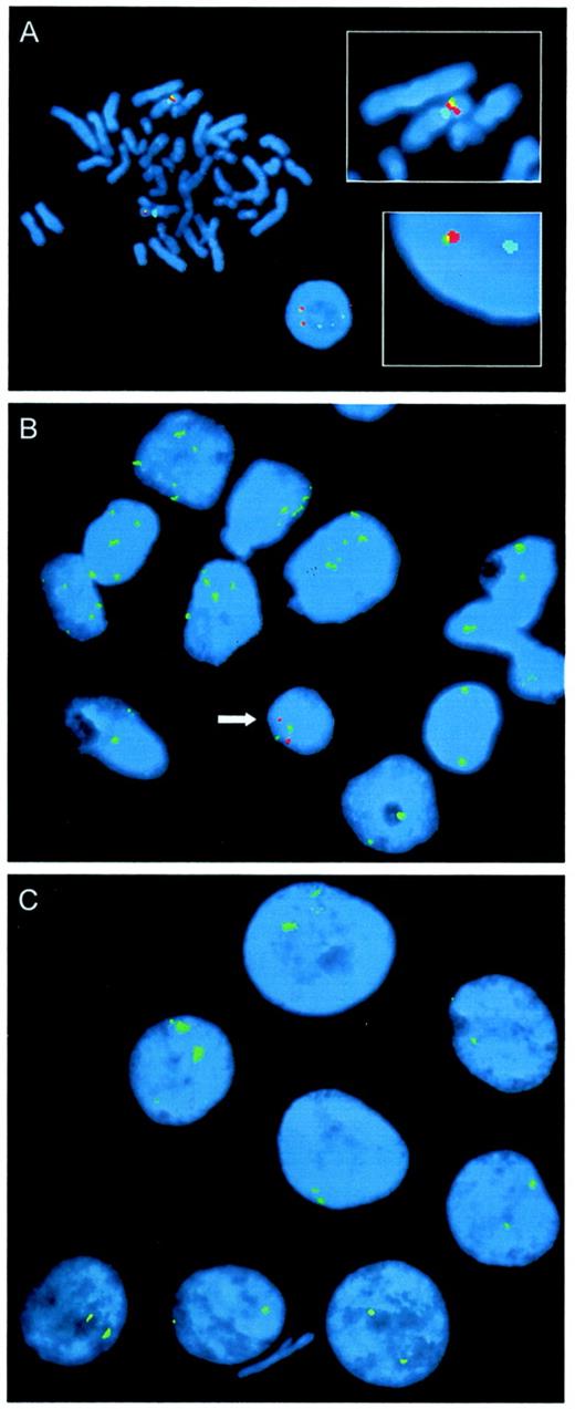 Homozygous Deletion of CDKN2A and Codeletion of the Methylthioadenosine ...