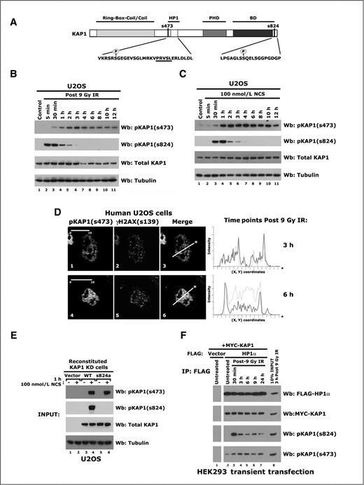 The ATM Substrate KAP1 Controls DNA Repair in Heterochromatin ...