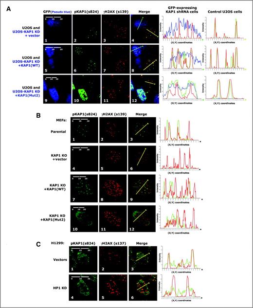 The ATM Substrate KAP1 Controls DNA Repair in Heterochromatin ...