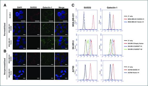 Multiple Functions of Sushi Domain Containing 2 (SUSD2) in Breast ...