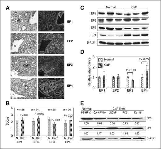 Significance of Divergent Expression of Prostaglandin EP4 and EP3 ...