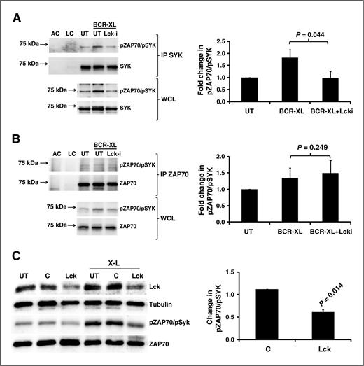 LCK Is an Important Mediator of B-Cell Receptor Signaling in Chronic ...