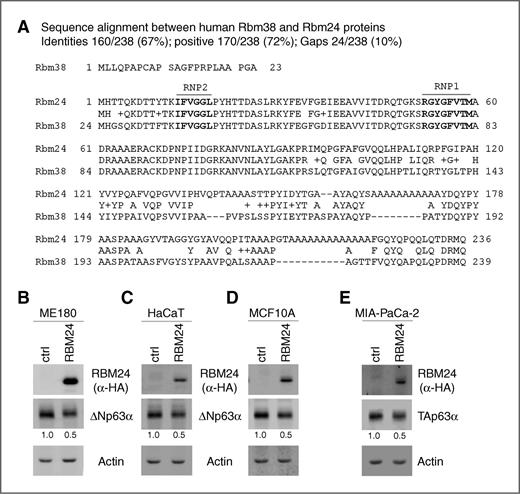 RNA-Binding Protein RBM24 Regulates p63 Expression via mRNA Stability ...