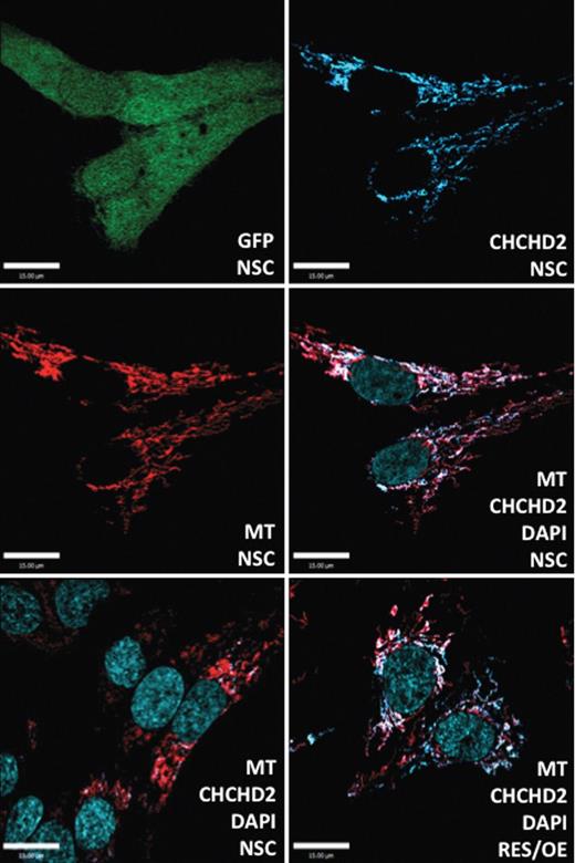 CHCHD2 Is Coamplified with EGFR in NSCLC and Regulates Mitochondrial ...