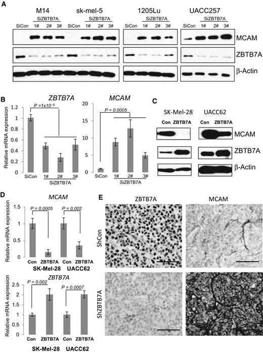 ZBTB7A Suppresses Melanoma Metastasis by Transcriptionally Repressing ...