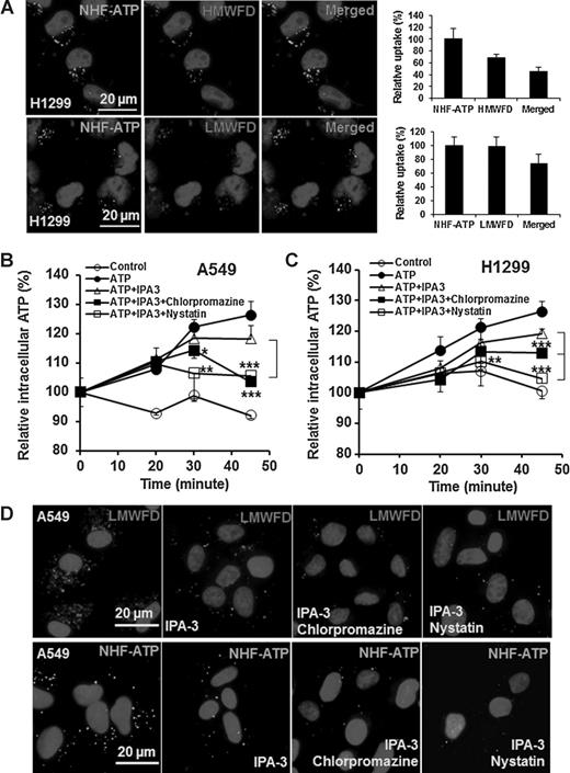 Extracellular ATP a New Player in Cancer Metabolism: NSCLC Cells ...