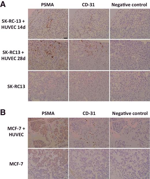 Induction of PSMA and Internalization of an Anti-PSMA mAb in the ...