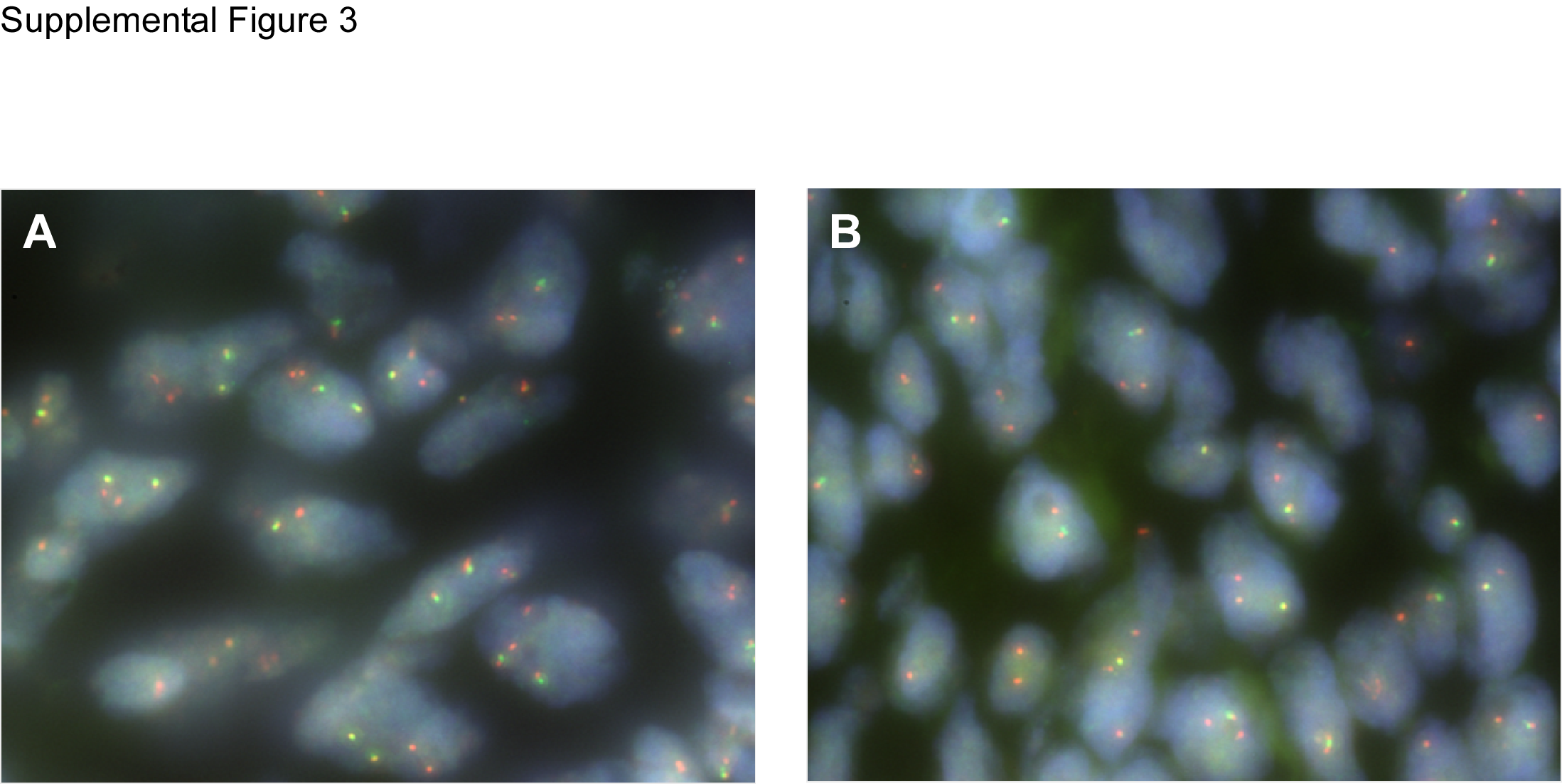 Evolution of Dermatofibrosarcoma Protuberans to DFSP-Derived ...