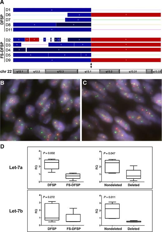 Evolution of Dermatofibrosarcoma Protuberans to DFSP-Derived ...
