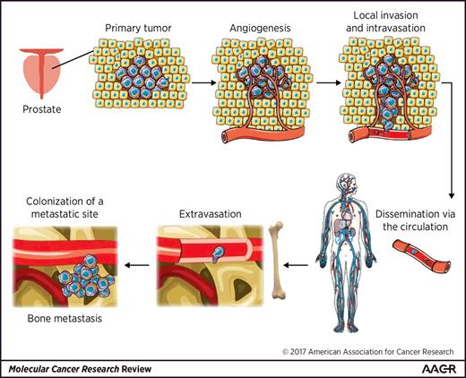Revisiting Seed and Soil: Examining the Primary Tumor and Cancer Cell ...