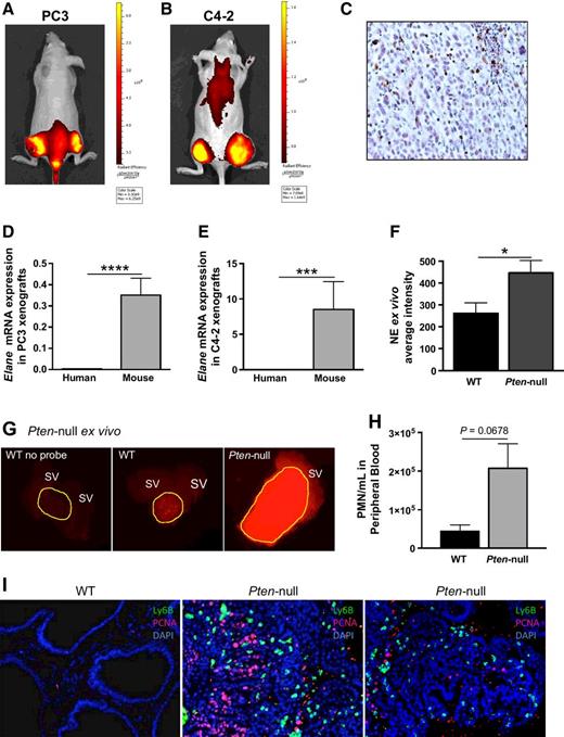 Infiltrating Myeloid Cells Exert Protumorigenic Actions via Neutrophil ...