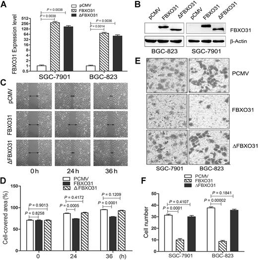 FBXO31 Suppresses Gastric Cancer EMT by Targeting Snail1 for ...