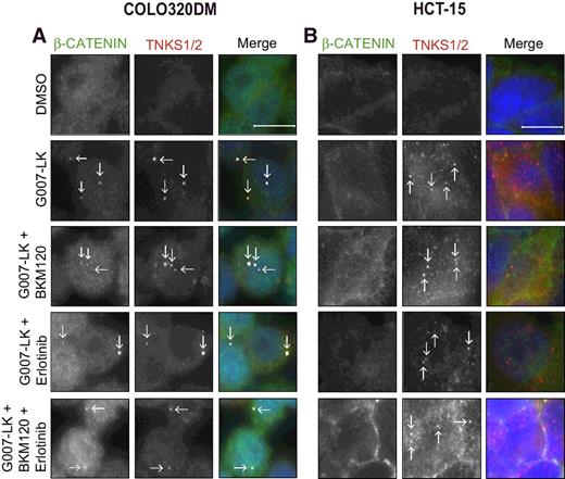 TANKYRASE Inhibition Enhances the Antiproliferative Effect of PI3K and ...