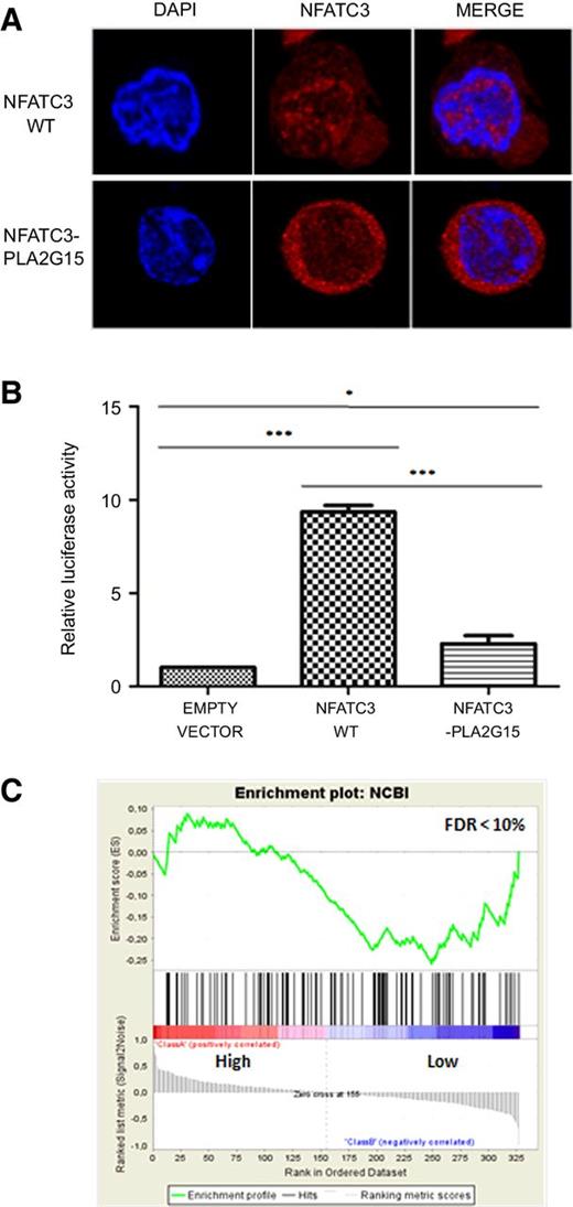 Novel Intergenically Spliced Chimera, NFATC3-PLA2G15, Is Associated ...