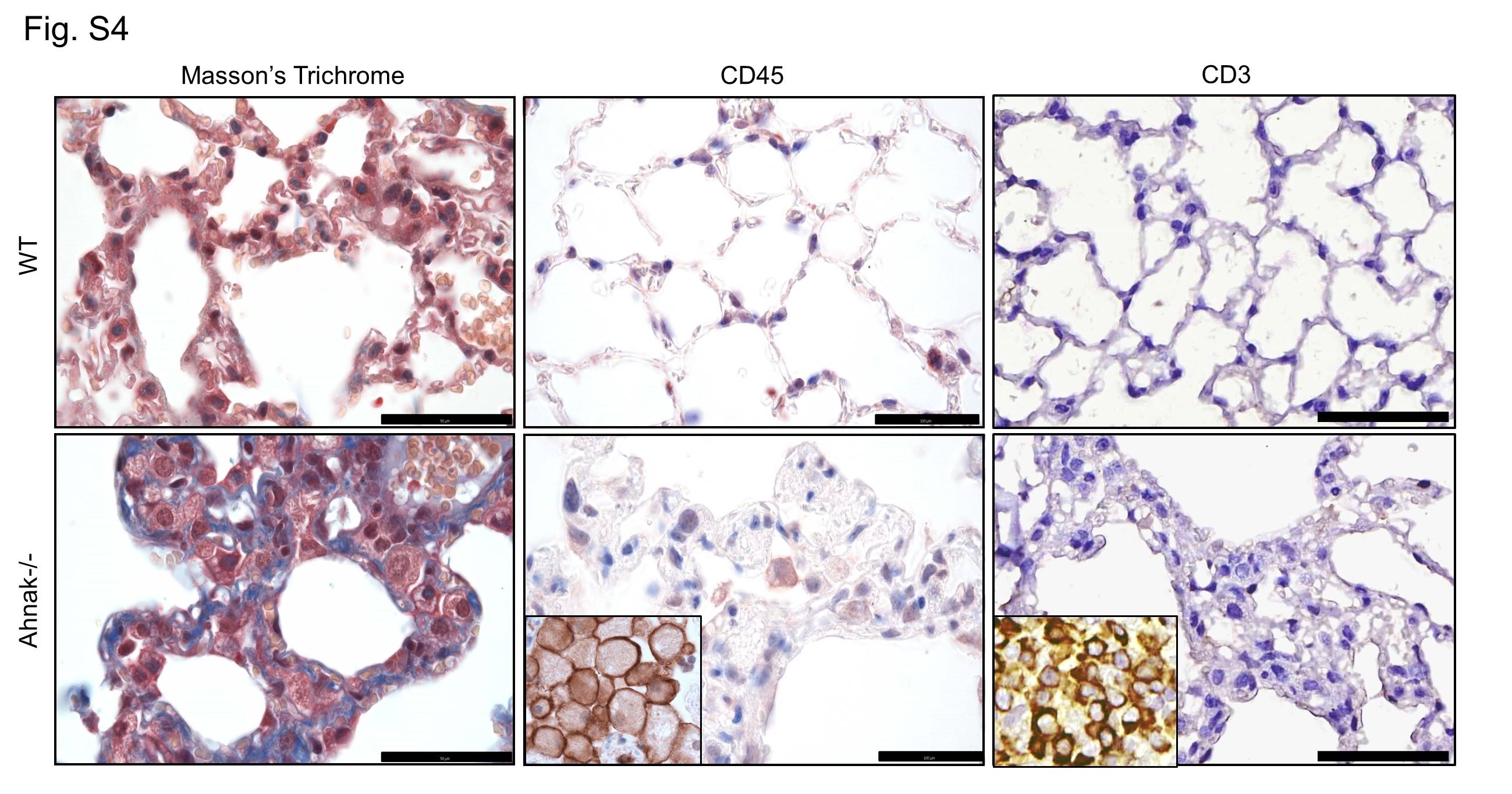 AHNAK Loss in Mice Promotes Type II Pneumocyte Hyperplasia and Lung ...