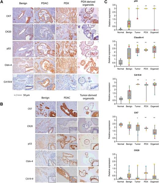 Human Organoids Share Structural and Genetic Features with Primary ...