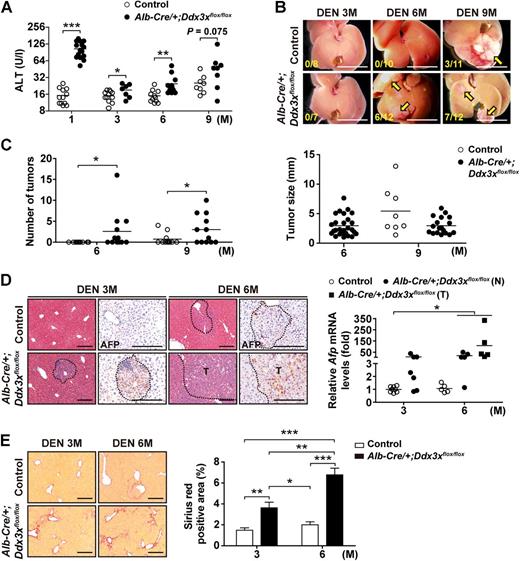 DNA Damage, Liver Injury, and Tumorigenesis: Consequences of DDX3X Loss ...