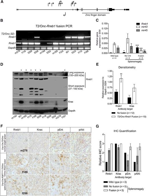 Sleeping Beauty Screen Identifies RREB1 and Other Genetic Drivers in ...