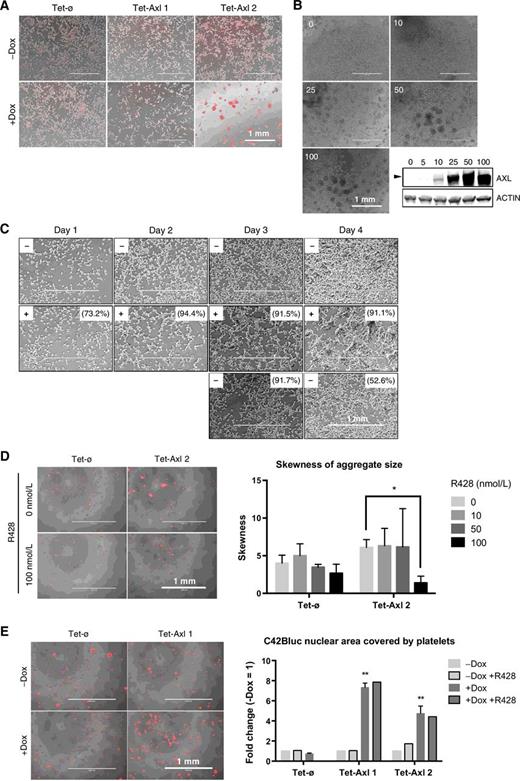 AXL Is a Putative Tumor Suppressor and Dormancy Regulator in Prostate ...