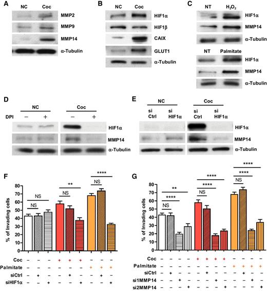 Periprostatic Adipose Tissue Favors Prostate Cancer Cell Invasion in an ...