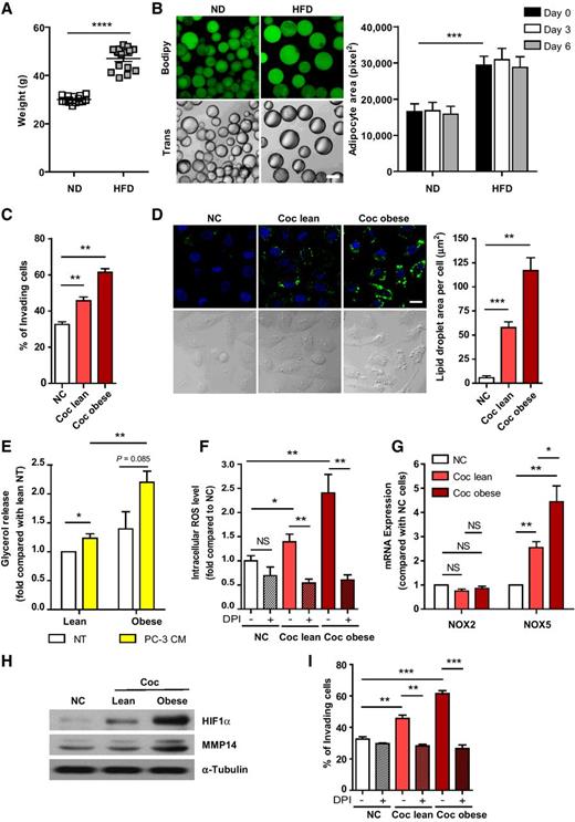 Periprostatic Adipose Tissue Favors Prostate Cancer Cell Invasion in an ...