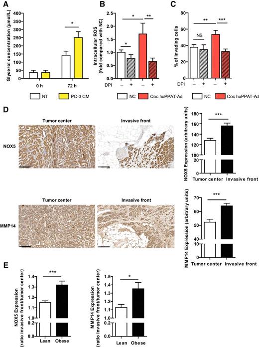 Periprostatic Adipose Tissue Favors Prostate Cancer Cell Invasion in an ...