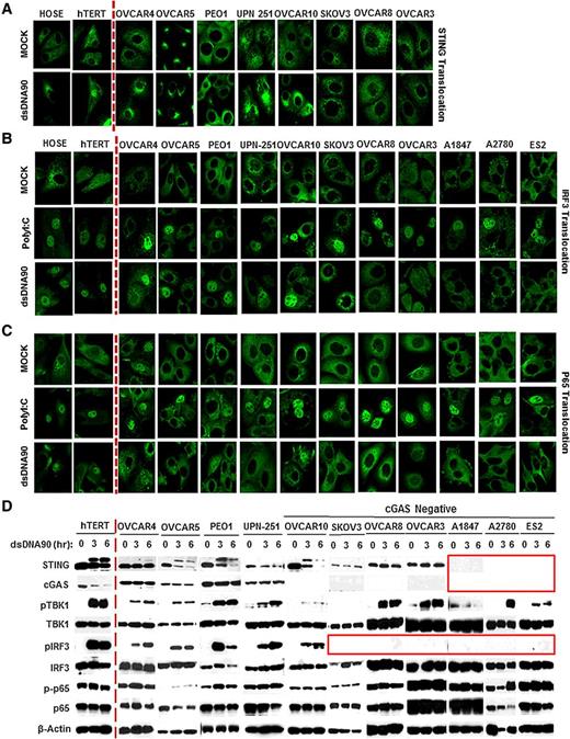 Ovarian Cancer Cells Commonly Exhibit Defective STING Signaling Which ...
