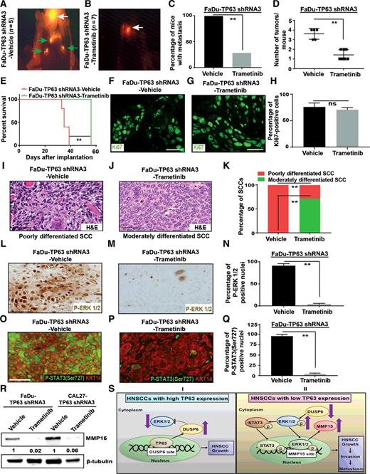 Loss of TP63 Promotes the Metastasis of Head and Neck Squamous Cell ...