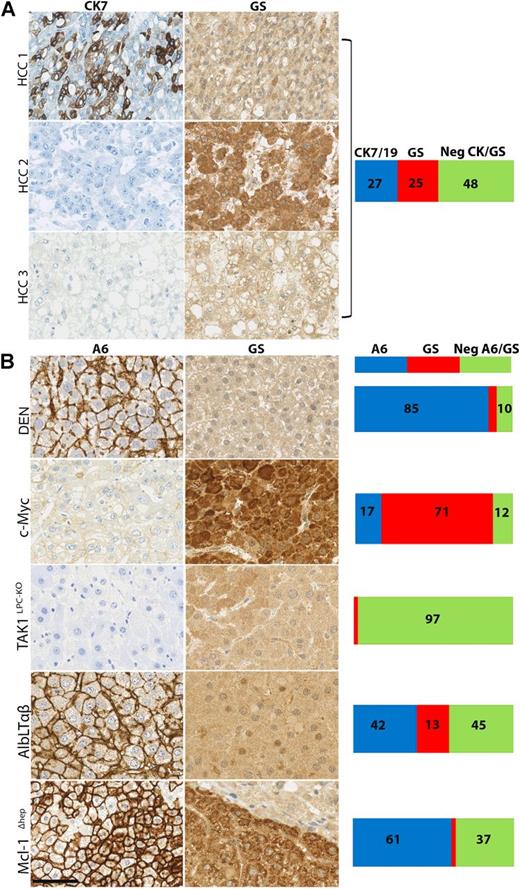 Characterization of HCC Mouse Models: Towards an Etiology-Oriented ...