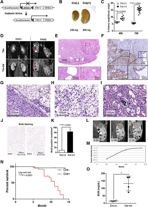 TFE3 Xp11.2 Translocation Renal Cell Carcinoma Mouse Model Reveals Novel Therapeutic Targets and ...