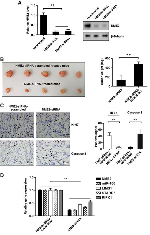NME2 Is a Master Suppressor of Apoptosis in Gastric Cancer Cells via ...