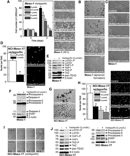 The YAP1 Signaling Inhibitors, Verteporfin and CA3, Suppress the ...