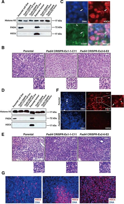 Endogenous PAD4 in Breast Cancer Cells Mediates Cancer Extracellular ...