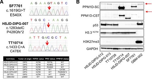 Targeting Mutant PPM1D Sensitizes Diffuse Intrinsic Pontine Glioma Cells to the PARP Inhibitor ...