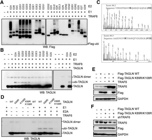 TAGLN Is Downregulated by TRAF6-Mediated Proteasomal Degradation in ...