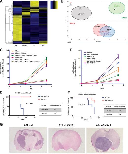 Elevated Asparagine Biosynthesis Drives Brain Tumor Stem Cell Metabolic ...