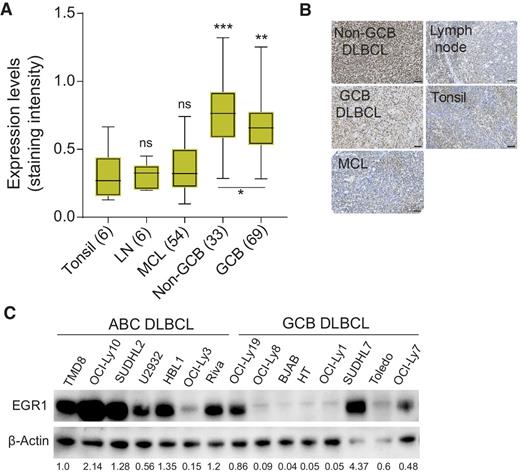 EGR1 Addiction in Diffuse Large B-cell Lymphoma | Molecular Cancer ...
