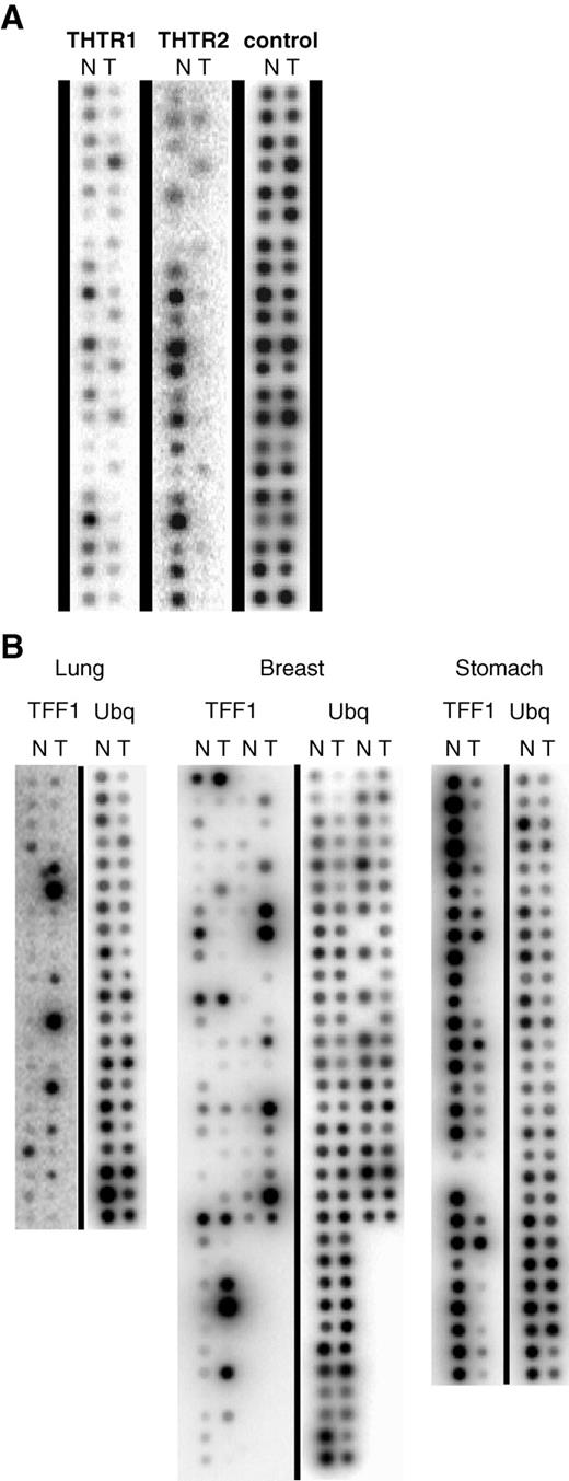 Thiamine Transporter Gene Expression and Exogenous Thiamine Modulate ...