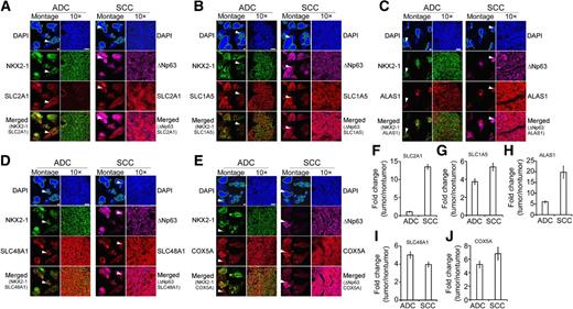 Heme Sequestration Effectively Suppresses the Development and ...