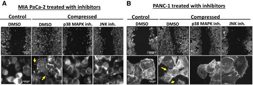 Mechanical Stress Signaling in Pancreatic Cancer Cells Triggers p38 MAPK- and JNK-Dependent ...