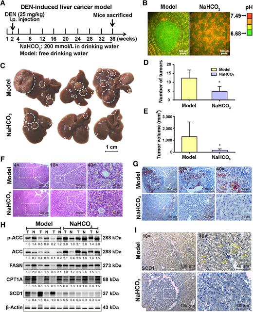 Tumor Microenvironment Acidity Triggers Lipid Accumulation in Liver ...