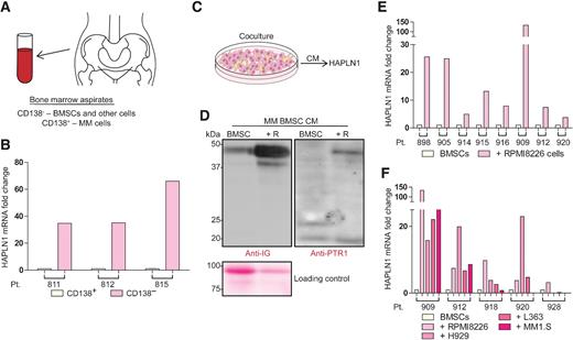 A Hyaluronan and Proteoglycan Link Protein 1 Matrikine: Role of Matrix ...
