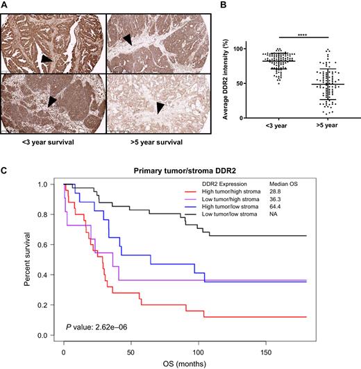 Stromal DDR2 Promotes Ovarian Cancer Metastasis through Regulation of ...