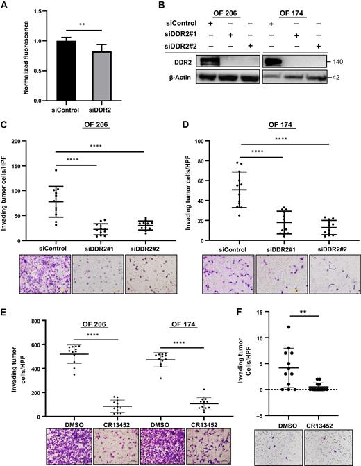 Stromal DDR2 Promotes Ovarian Cancer Metastasis through Regulation of ...