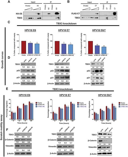 TBX3 Promotes Cervical Cancer Proliferation and Migration via HPV E6 ...