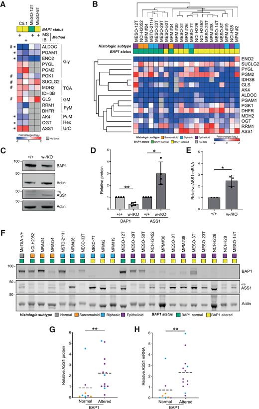 BAP1 Loss Is Associated with Higher ASS1 Expression in Epithelioid ...