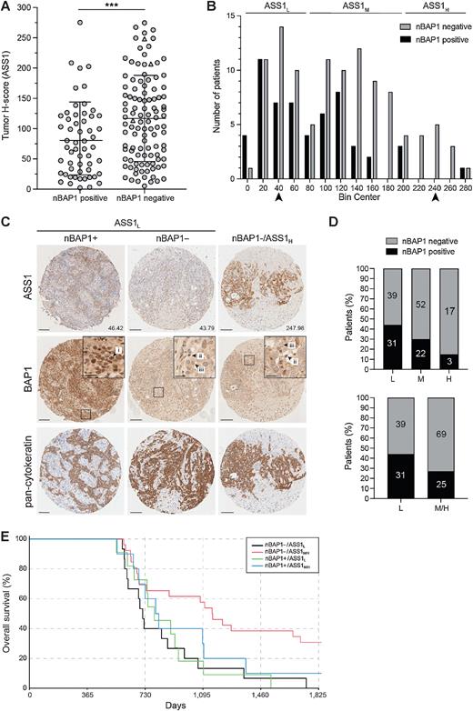 BAP1 Loss Is Associated with Higher ASS1 Expression in Epithelioid ...